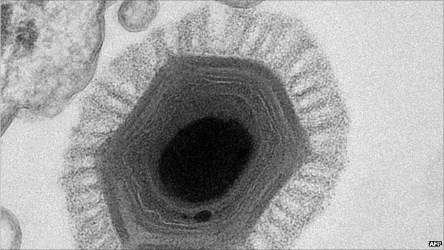 Megavirus discovered in the Pacific Ocean off Chile - BBC News