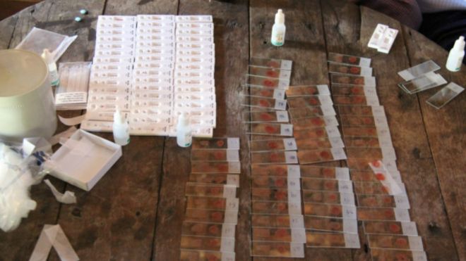 Parasit malaria yang kebal terhadap obat ditemukan di Myanmar - BBC ...