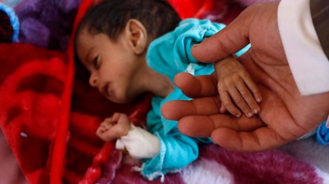 Ricuh pembagian sedekah Ramadan di Yaman tewaskan hampir 80 orang - Gagalnya pengendalian massa ...