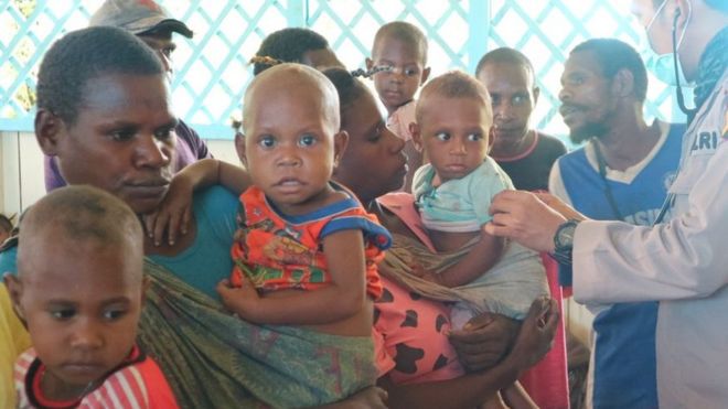 Papua Tengah krisis kelaparan akibat gagal panen, pemerintah perpanjang 'masa darurat' dan janji ...