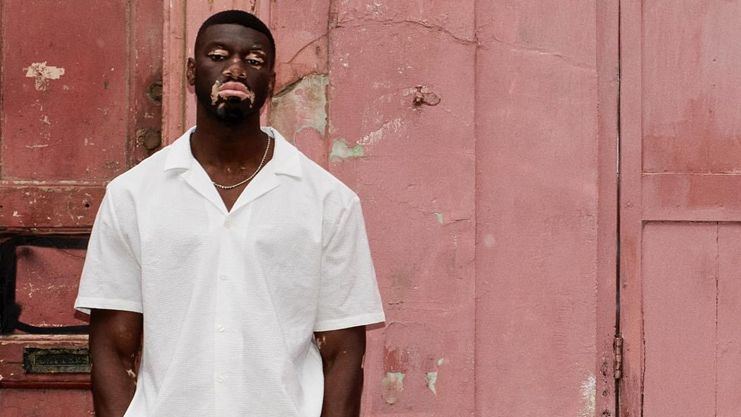 Stoke-on-Trent man with vitiligo wants be role model he never had - BBC ...