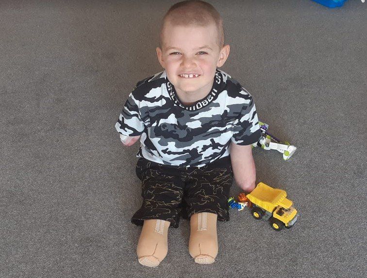 Luke Mortimer: Skipton boy who lost limbs to meningitis back home - BBC ...