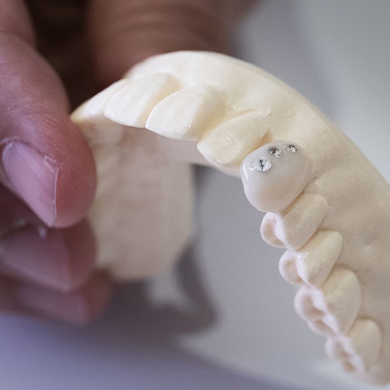 Yaeba dentistry: The appeal of pointy teeth - BBC News