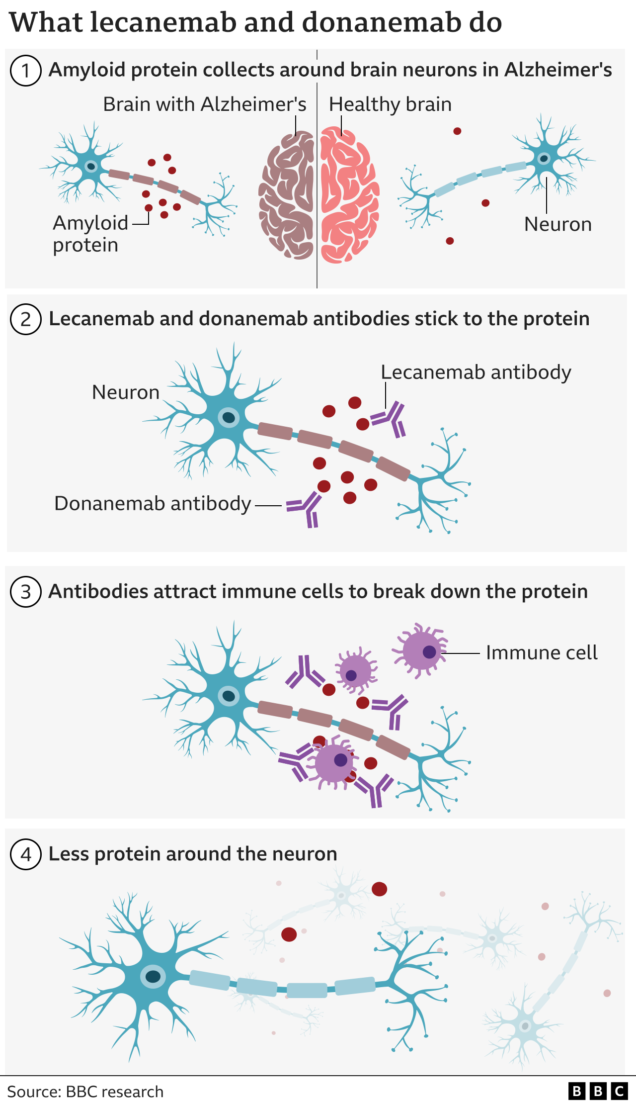 NHS not ready for new Alzheimer's drugs lecanemab and donanemab, warns ...