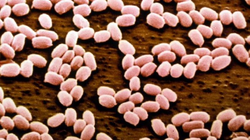 Russia anthrax outbreak affects dozens in north Siberia - BBC News