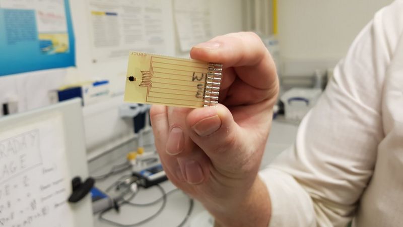 Sepsis test could show results 'in minutes' - BBC News