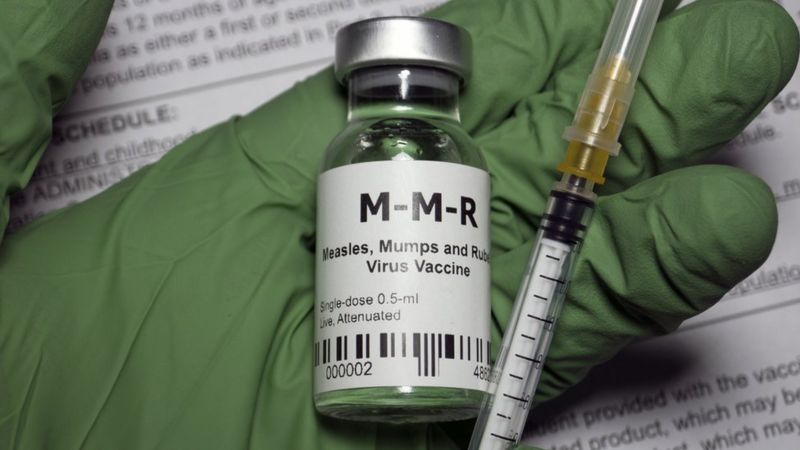 Suspected mumps outbreak at Nottinghamshire school - BBC News