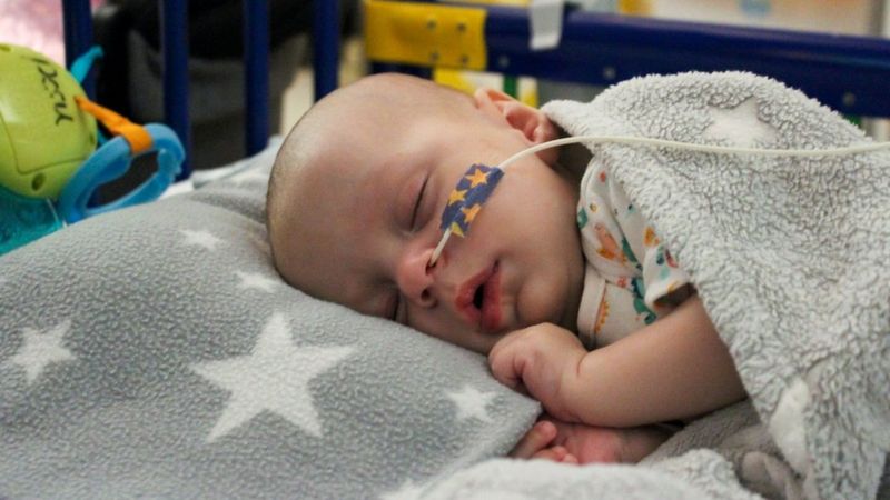 Sheffield Children's Hospital: Baby 'doing OK' after SMA drug first ...