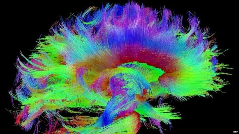Why brains are beautiful - BBC News