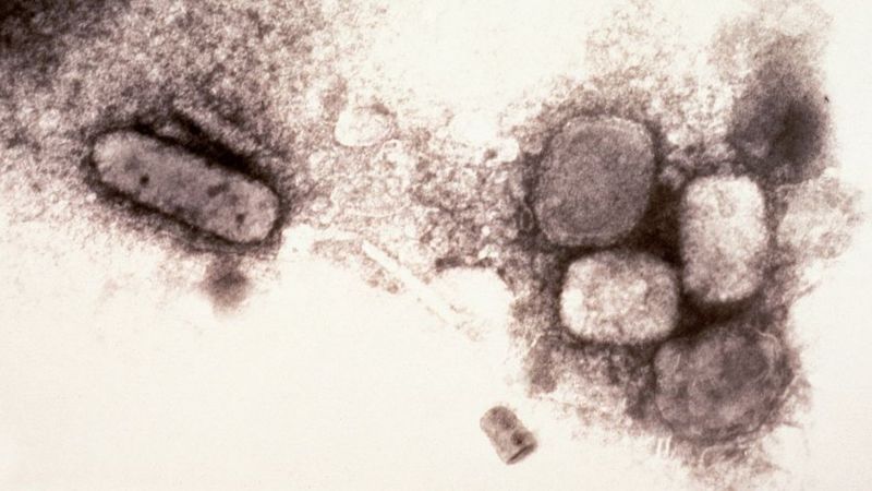 How smallpox claimed its final victim - BBC News