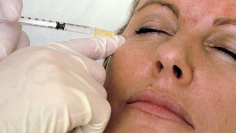 Woman's Botox party warning after lip filler swelling - BBC News