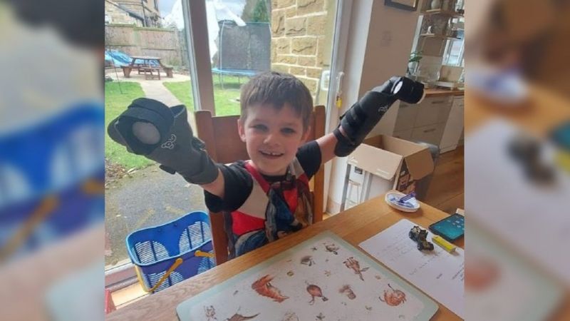 Luke Mortimer: Aim to give Skipton boy who lost limbs 'best life' - BBC ...