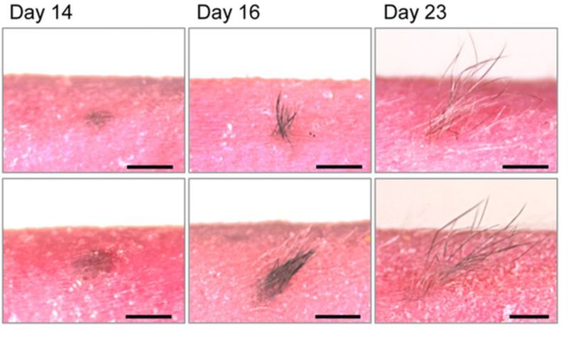 Promising lab-grown skin sprouts hair and grows glands - BBC News