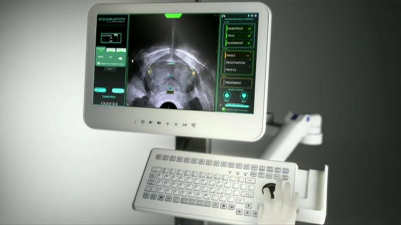 Prostate cancer: Pioneering research at Queen's University Belfast ...