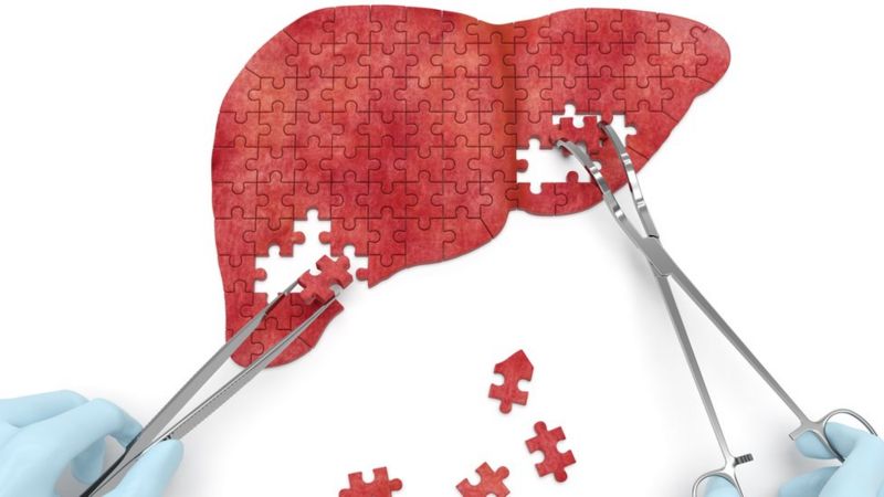 Novos surtos em São Paulo e no Rio revertem uma década de queda nos ...