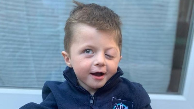 Hull parents' joy as son starts nursery after brain tumour - BBC News