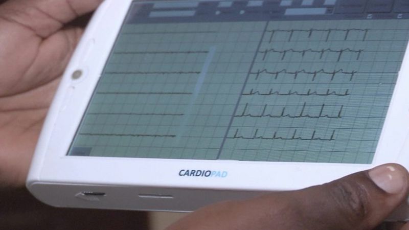 Five African inventions to look out for in 2017 - BBC News