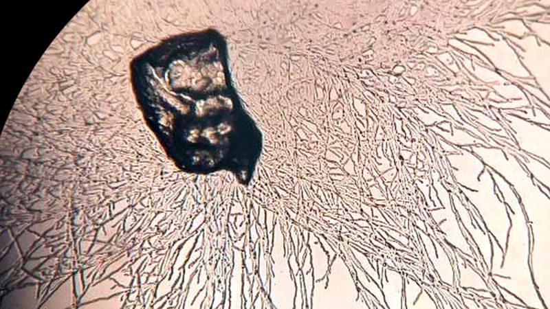 The fungus and bacteria tackling plastic waste - BBC News