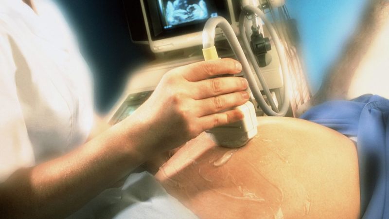 Womb transplants: how do they work? - BBC News