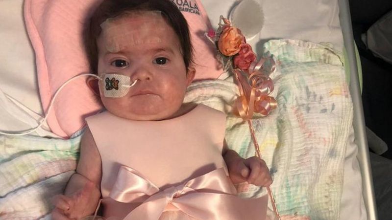Poorly baby is bridesmaid at Bristol Children's Hospital ceremony - BBC ...
