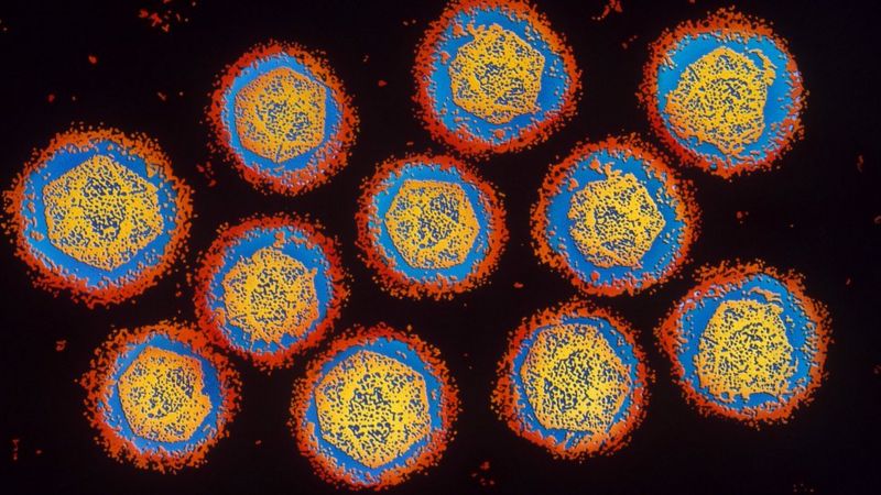 Bumper load of new viruses identified - BBC News