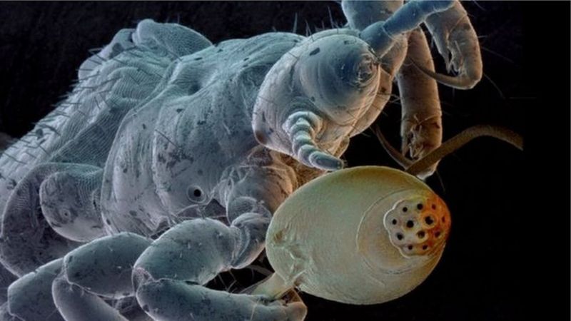 Deep clean of court after lice infestation - BBC News