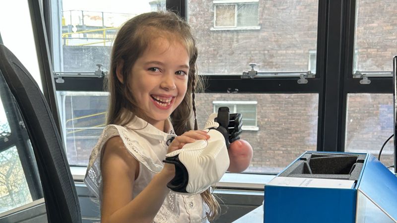 Children get bionic arms after fundraising appeal success - BBC News
