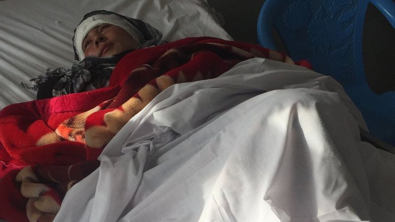 Afghan woman's ears cut off by husband - BBC News