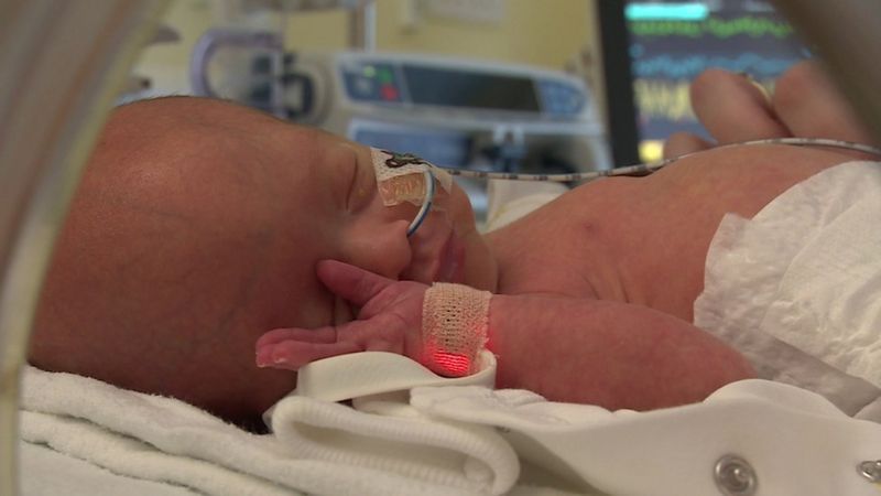 Spina bifida: Keyhole surgery repairs baby spine in womb - BBC News