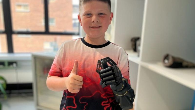 New bionic arm 'absolutely life-changing' for boy from Bude - BBC News