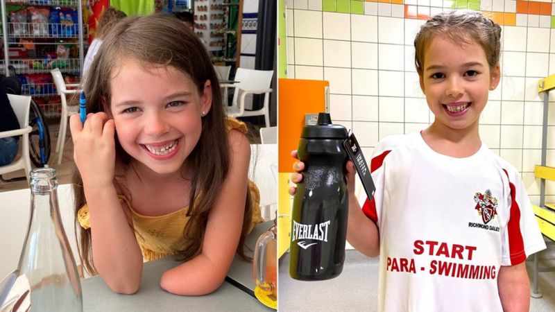 Children with limb difference to get 'life-changing' prosthetic arms ...