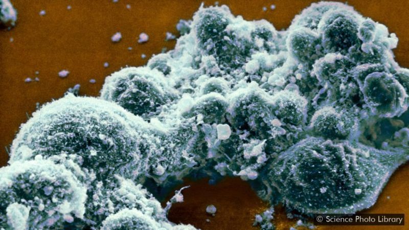 Sẽ ra sao nếu virus corona và tất cả các loại virus biến mất? - BBC ...