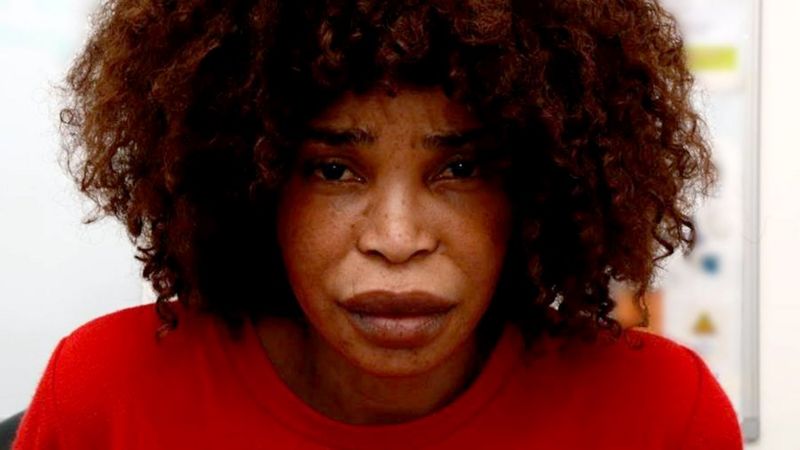 Mark van Dongen acid attack: Berlinah Wallace jailed - BBC News