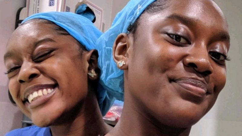 Conjoined twins: 'We always knew we were different' - BBC News