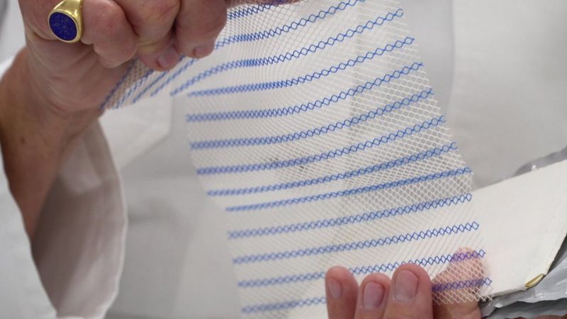 Hernia mesh complications 'affect more than 100,000' - BBC News
