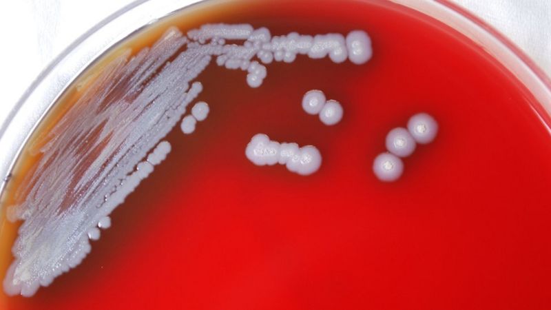 Dangerous bacterium found in Mississippi soil - BBC News