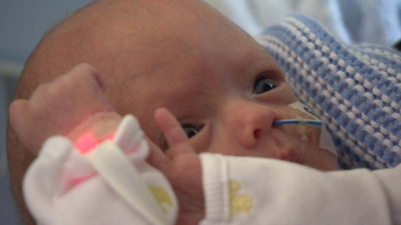 Spina bifida: Keyhole surgery repairs baby spine in womb - BBC News