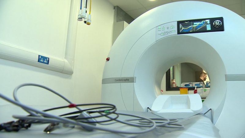Heart scanner world first for Ulster Hospital - BBC News