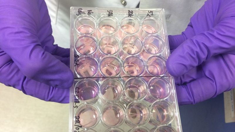 Artificial meat: UK scientists growing 'bacon' in labs - BBC News