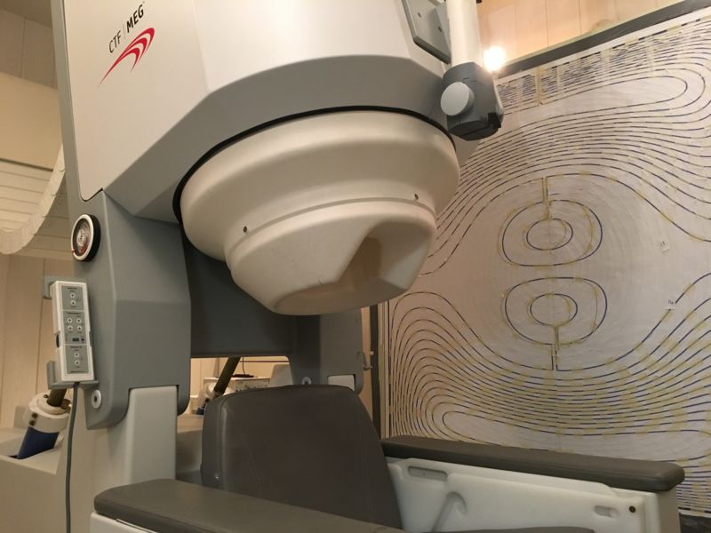 The wearable brain scanner you can move around in - BBC News