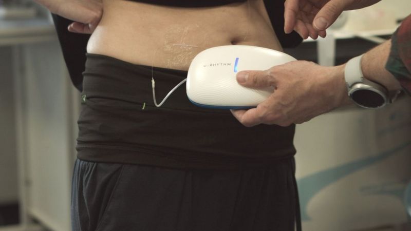 Device developed in Bristol offers 'revolution' in hormone ...