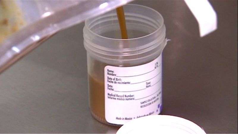 Liquid faeces food curing West Midlands C. diff patients - BBC News