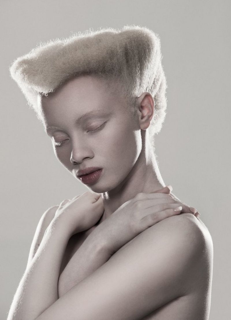 In pictures: Albinism and perceptions of beauty - BBC News