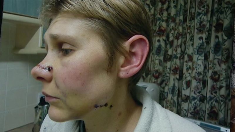 Stalking victims being failed, say watchdogs - BBC News