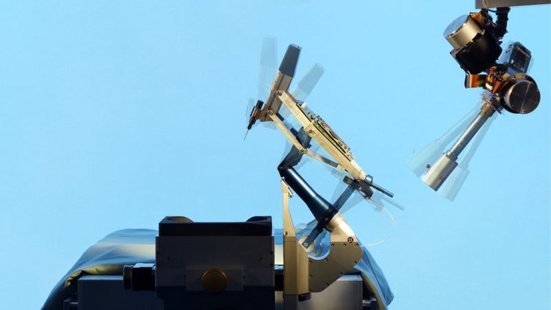 Robot operates inside eye in world first - BBC News