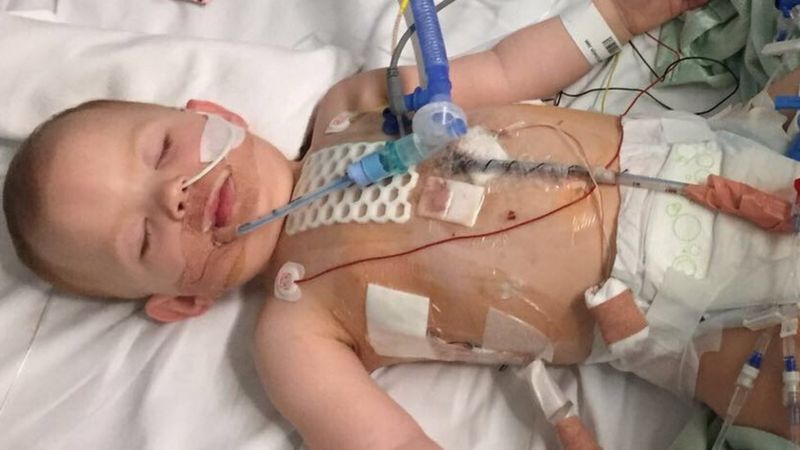 Baby's heart surgery cancelled five times by Leeds hospital - BBC News
