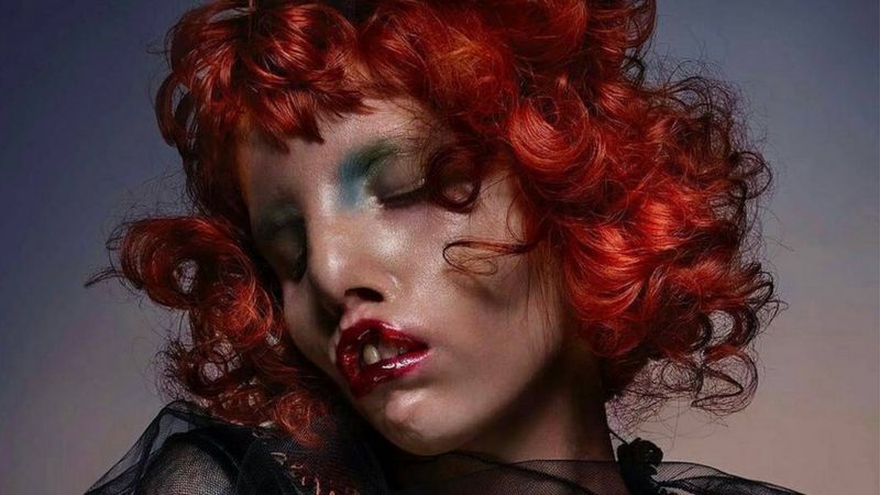 Meet the model with cat eye syndrome - BBC News