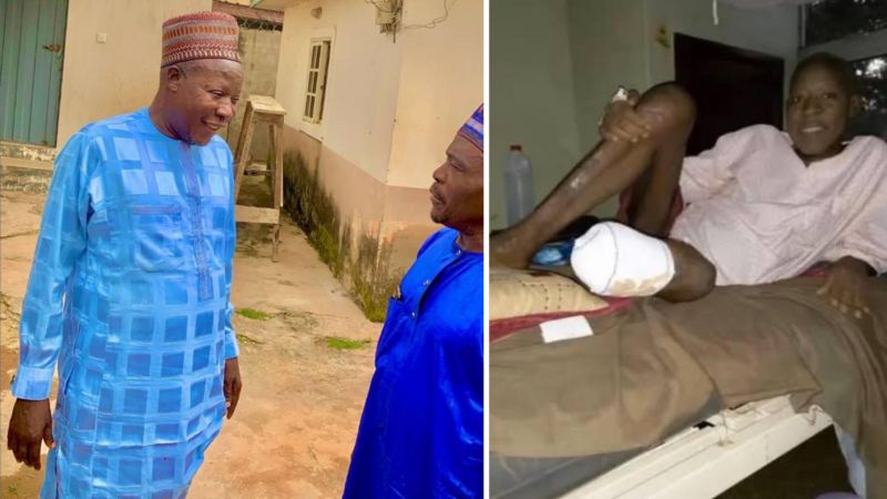 Mr Ibu leg amputated: Anoda actor wey dem amputate im leg advise comic actor John Okafor - BBC ...