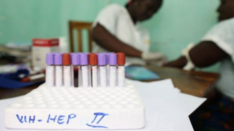 Zimbabwe: Government spend $5m on HIV testing machine - BBC News Pidgin