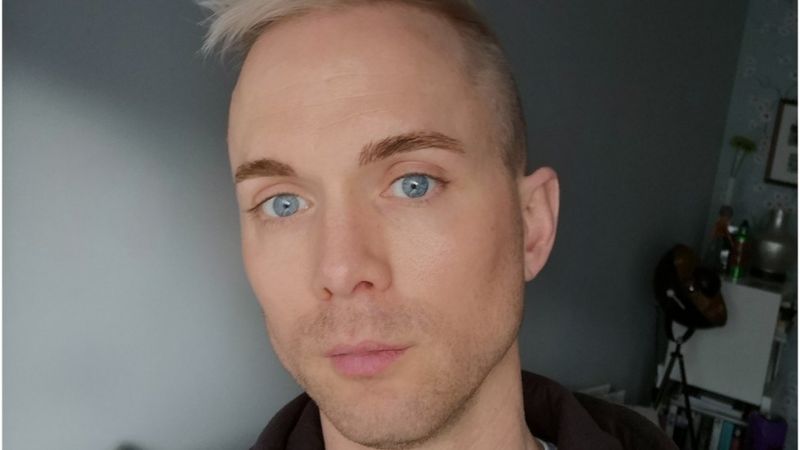 Covid-19: The similarities between 'long Covid' and ME - BBC News